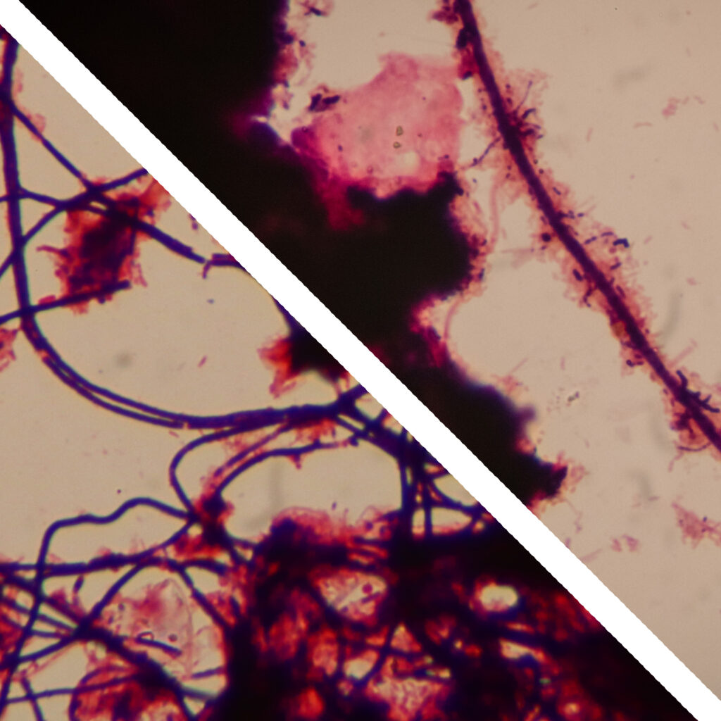 Filamentous bacteria identification tool – Feralco WaterLab