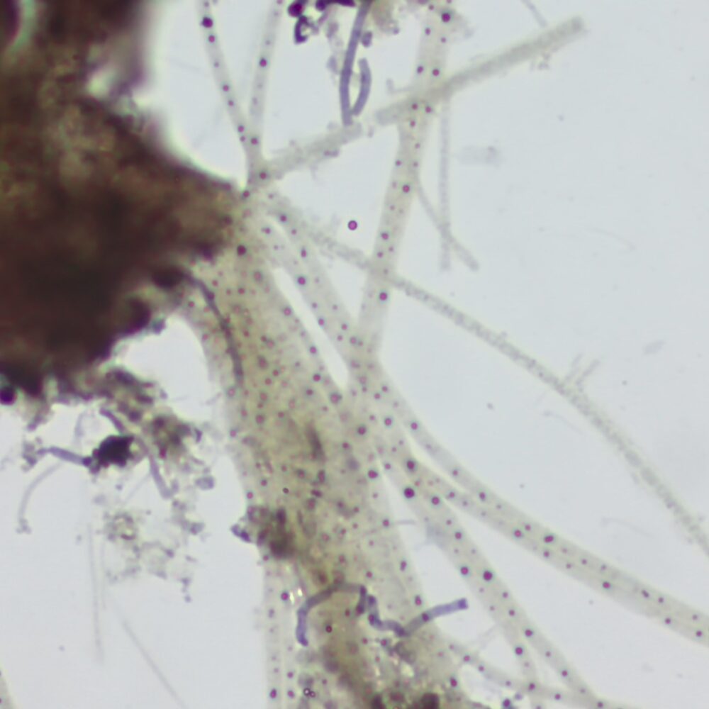 Fadenbakterien – Feralco WaterLab